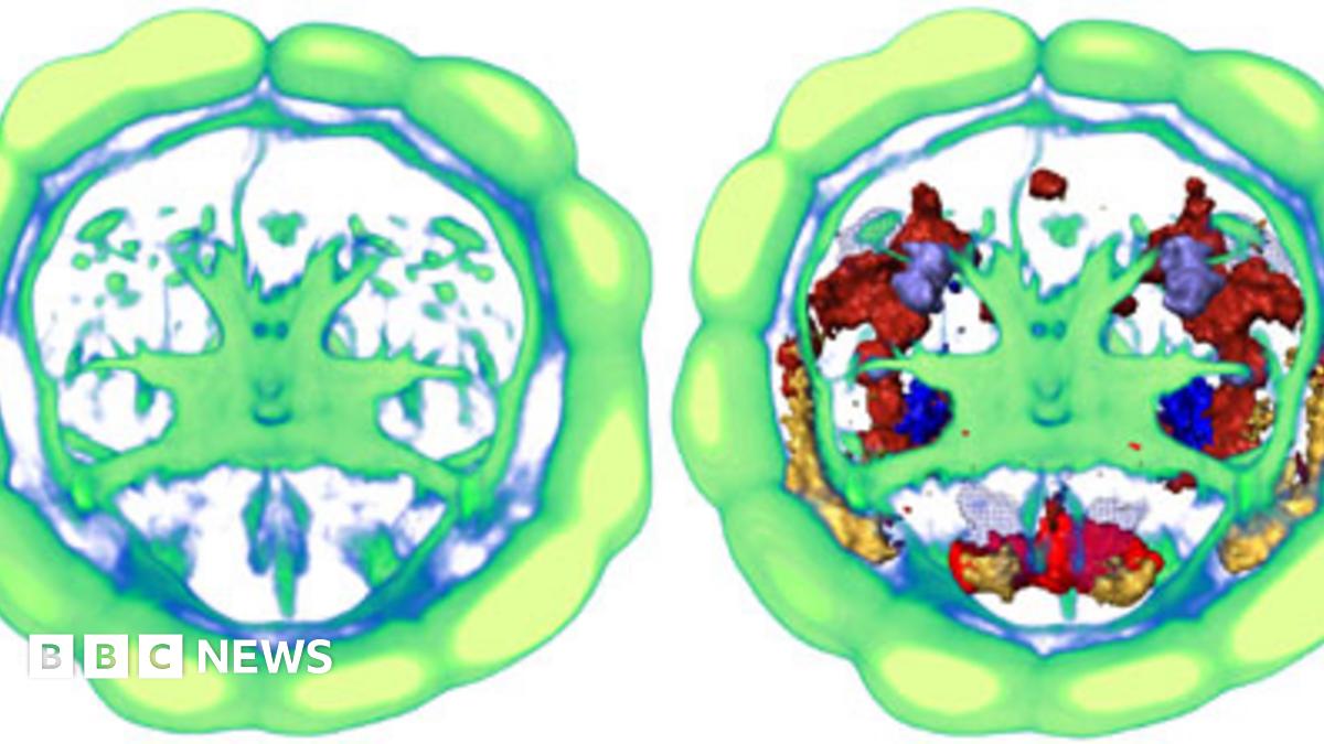 Worm gene maps give clue to higher brain evolution - BBC News