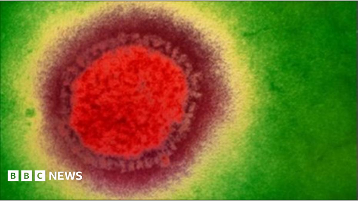 Call to vaccinate against possible H2N2 flu pandemic - BBC News