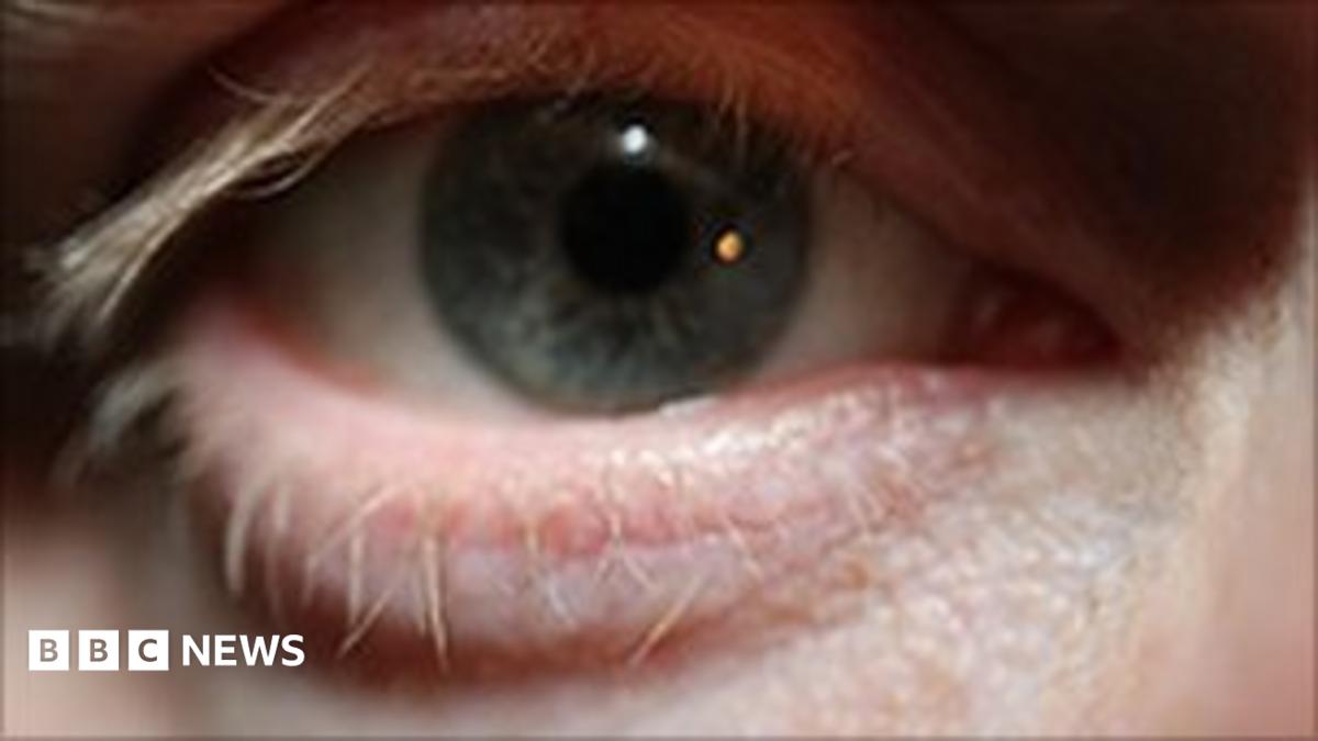Scotland's free eye tests 'benefiting rich more than poor' - BBC News
