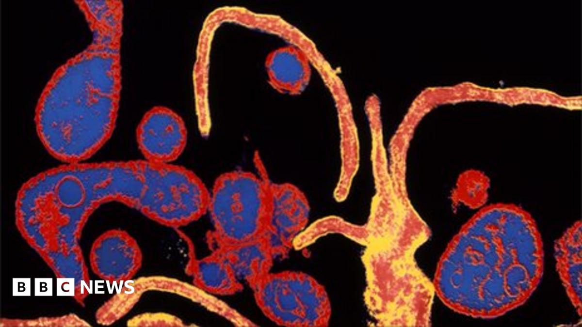 Measles at Ysgol Eifionydd, Porthmadog, prompts new MMR warning - BBC News