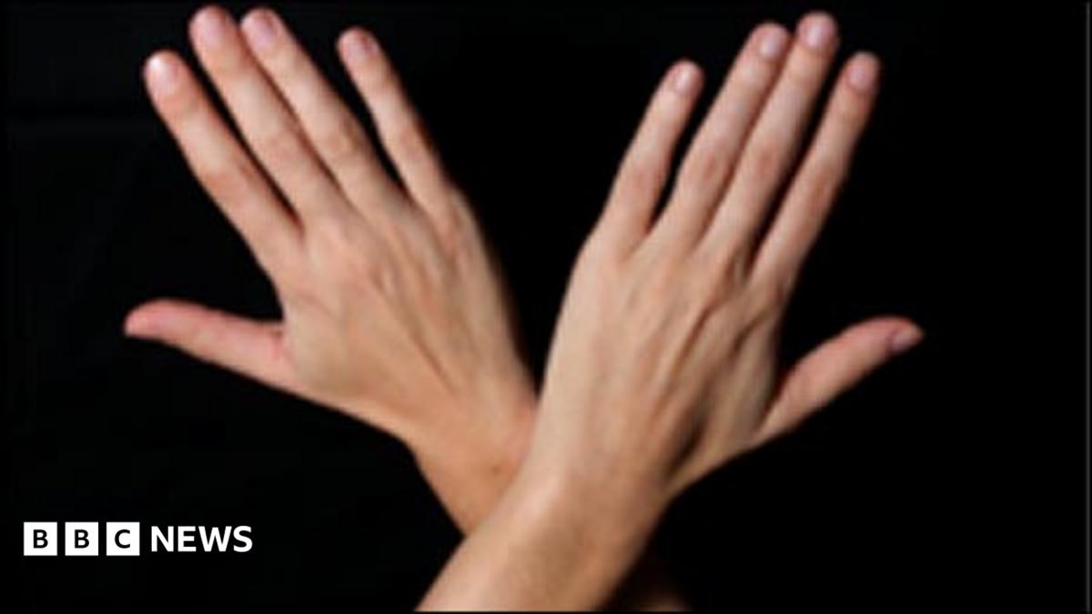 Crossing your arms 'relieves hand pain' - BBC News