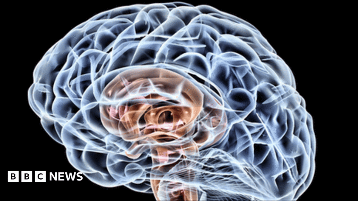 Ashford and St Peter's hospital trust 'worst for stroke patients' - BBC ...