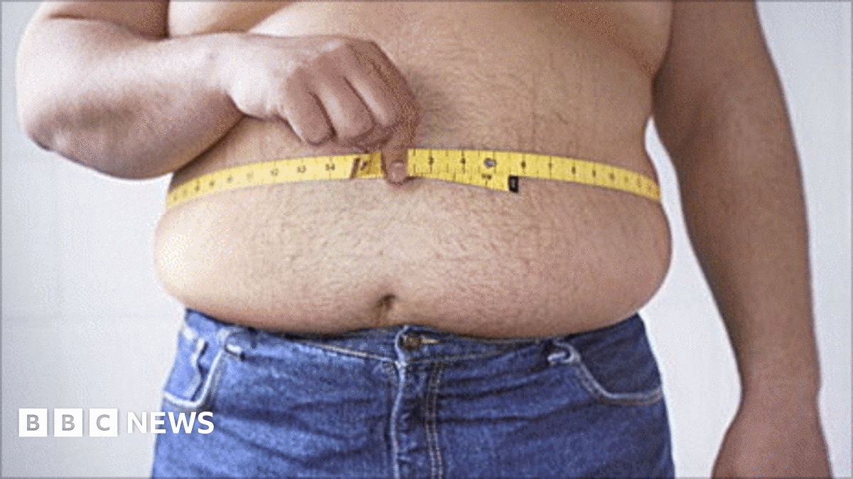 NHS 'ill-prepared to deal with obese patients' - BBC News