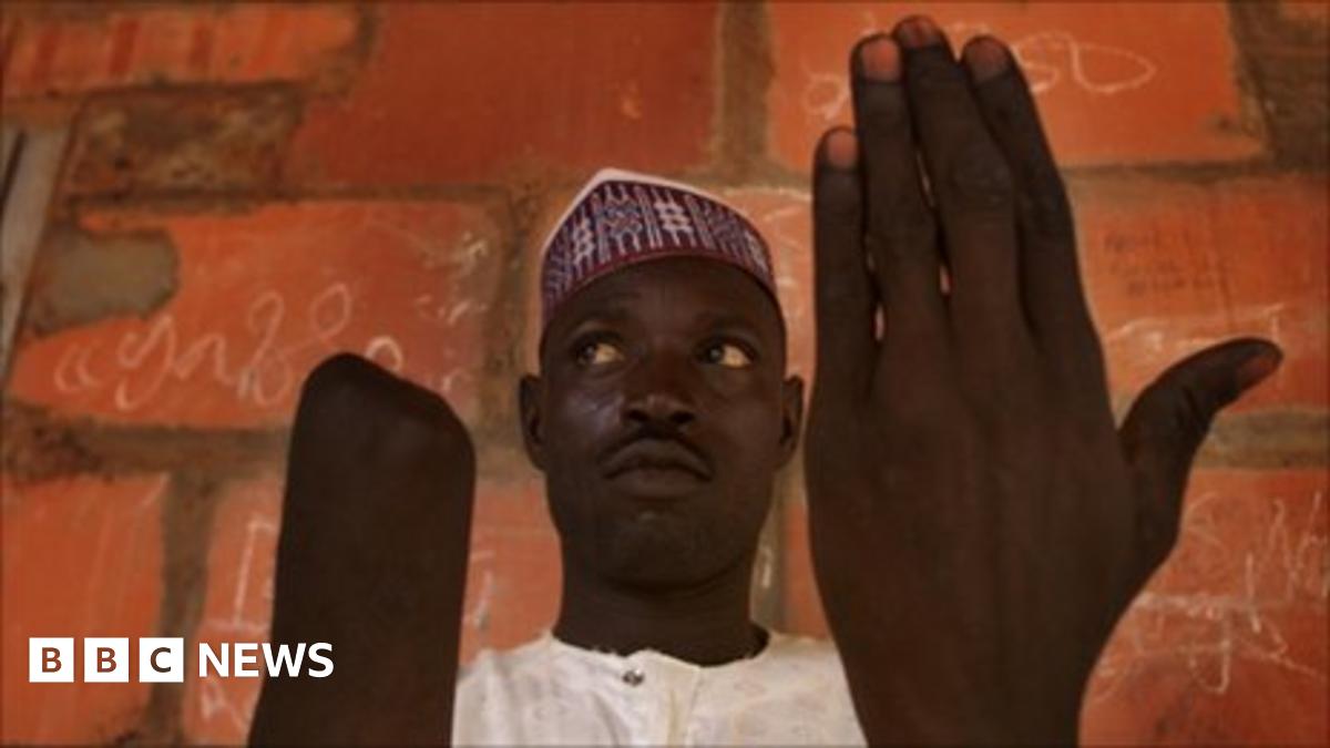 Nigeria's Zamfara Sharia court orders amputation - BBC News