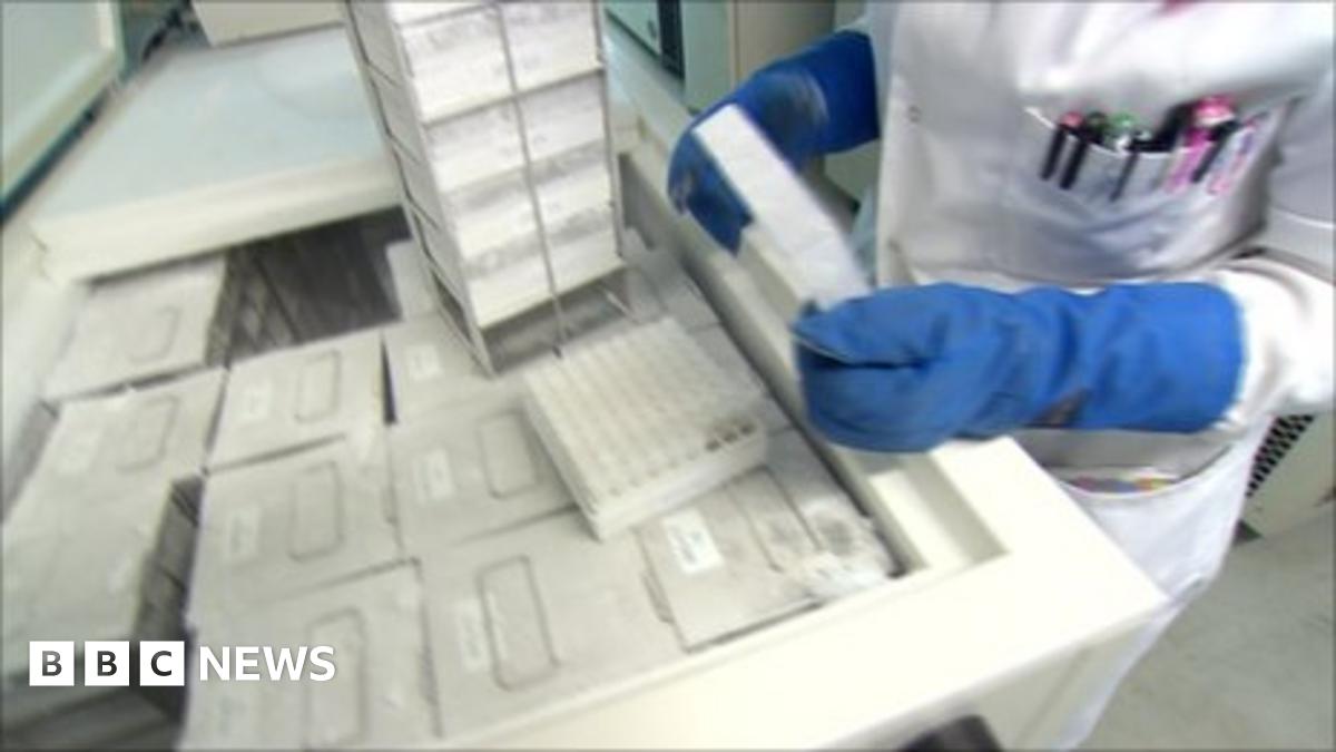 UK's first brain tumour tissue bank launched in Glasgow - BBC News