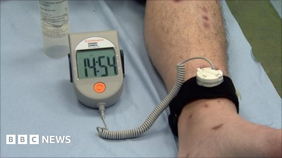 Glasgow surgeon using ultrasound to treat fractures - BBC News