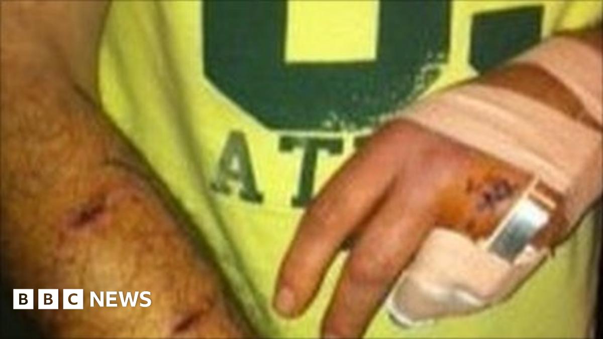 Postman mauled by Alsatian thought he was going to die - BBC News