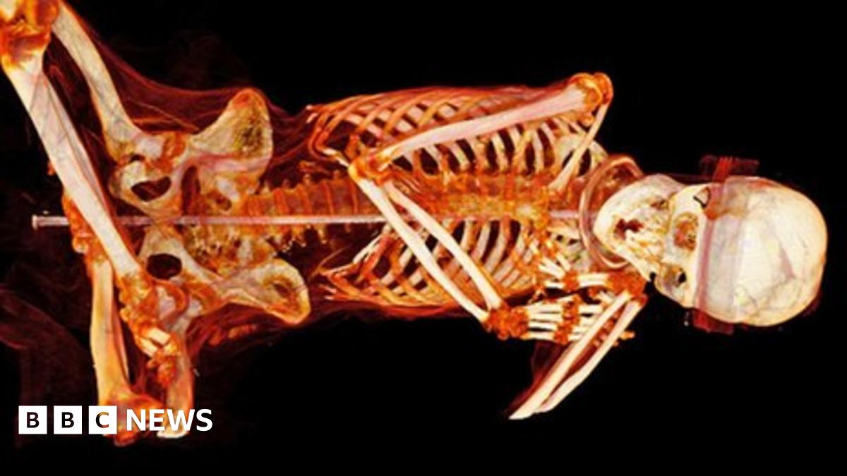 Scientists glimpse inside a Peruvian mummy - BBC News