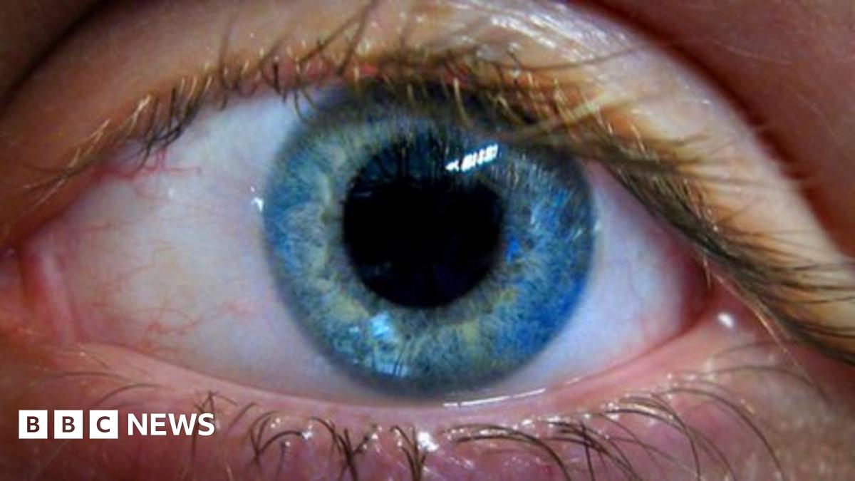 Doctor trials laser treatment to change eye colour - BBC News