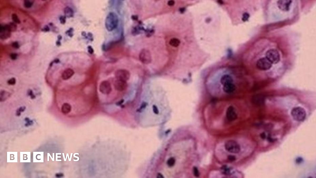 Mum's testing affects HPV jab uptake, says survey - BBC News