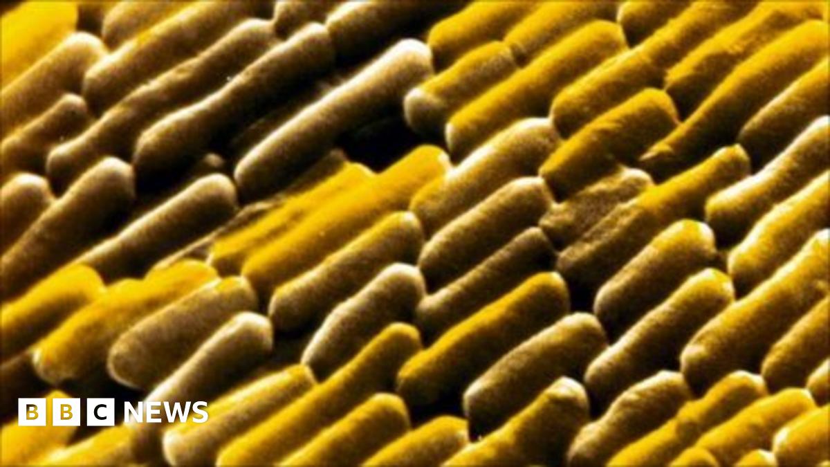 Scottish anthrax outbreak 'worst in UK in 50 years' - BBC News