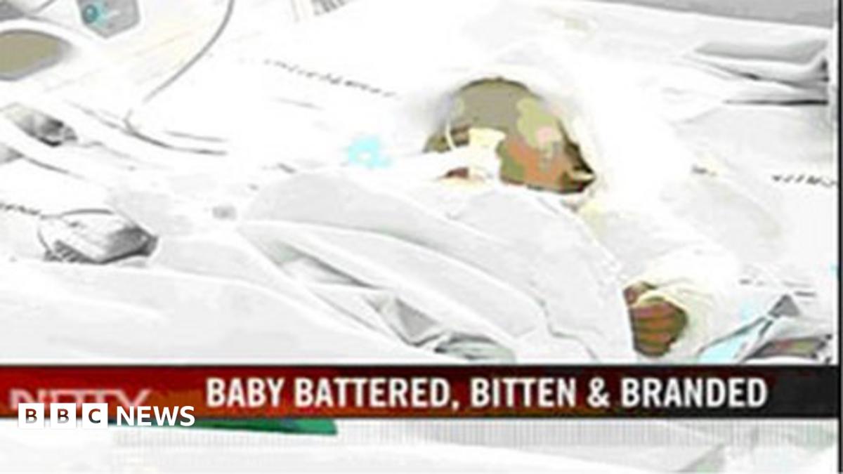 Battered baby fighting for life in India hospital - BBC News