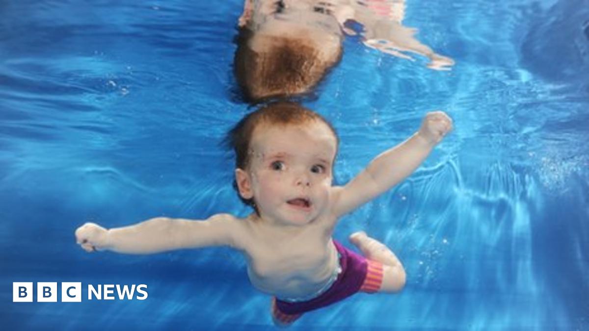 Syndrome without a name: Living without a diagnosis - BBC News
