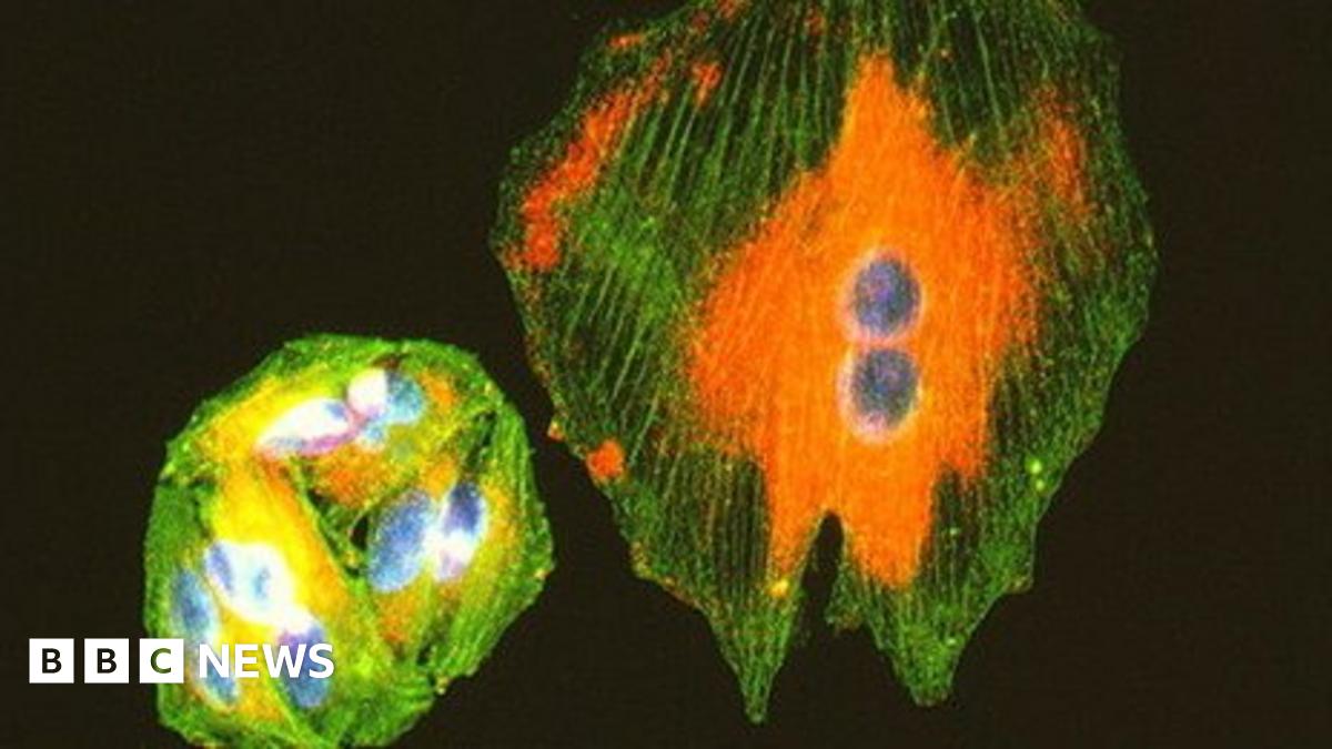 Skin cancer drug hopes raised by study - BBC News