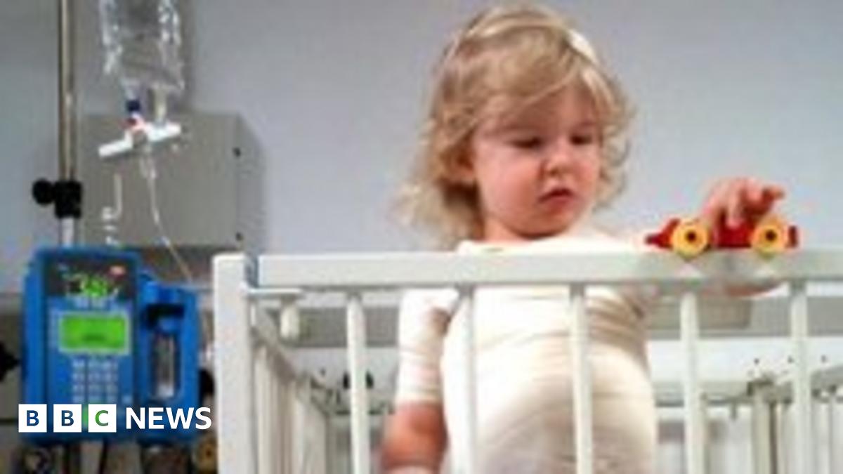 Tea-scald toddler Zed Merrick given spray-on skin - BBC News