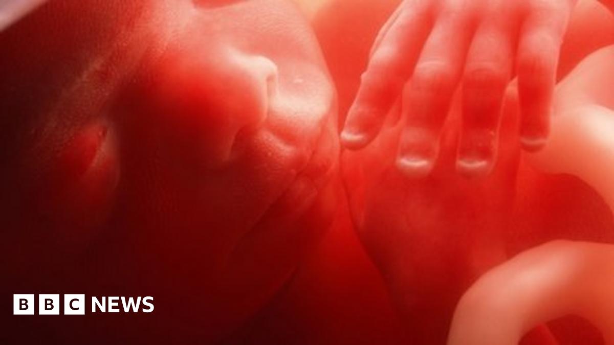 Study links womb environment to childhood obesity - BBC News