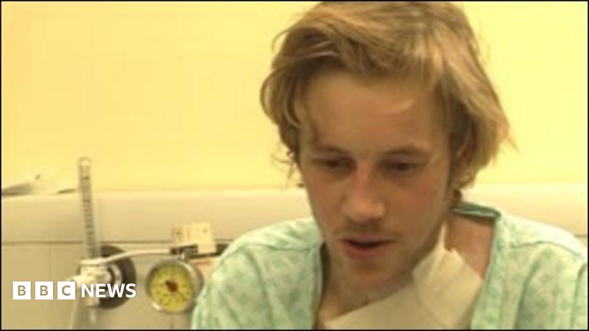 Leading UK burns unit 'matches best in world for survival' - BBC News