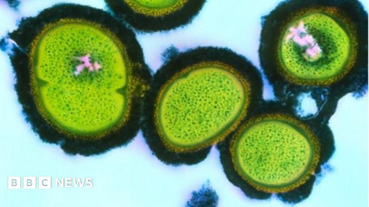 New MRSA bacteria test developed by Edinburgh University scientists ...