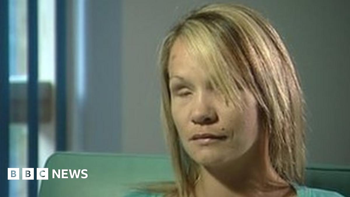 Blinded assault victim 'buried alive' - BBC News