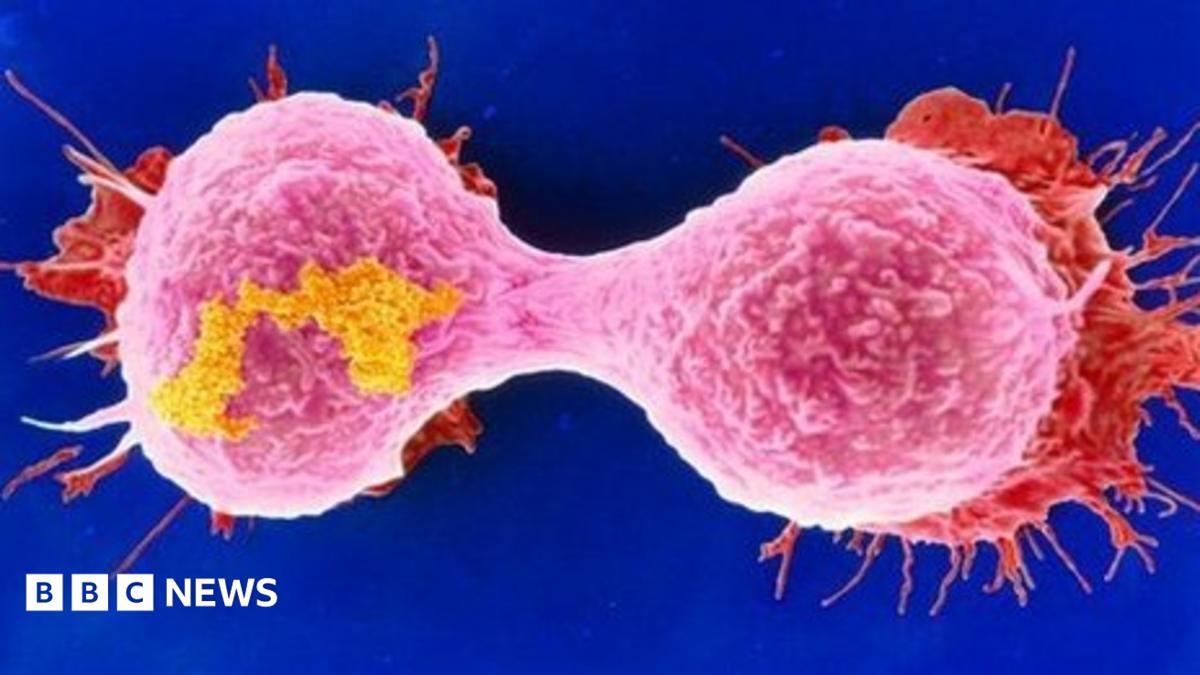 Way to spot breast cancer years in advance - BBC News
