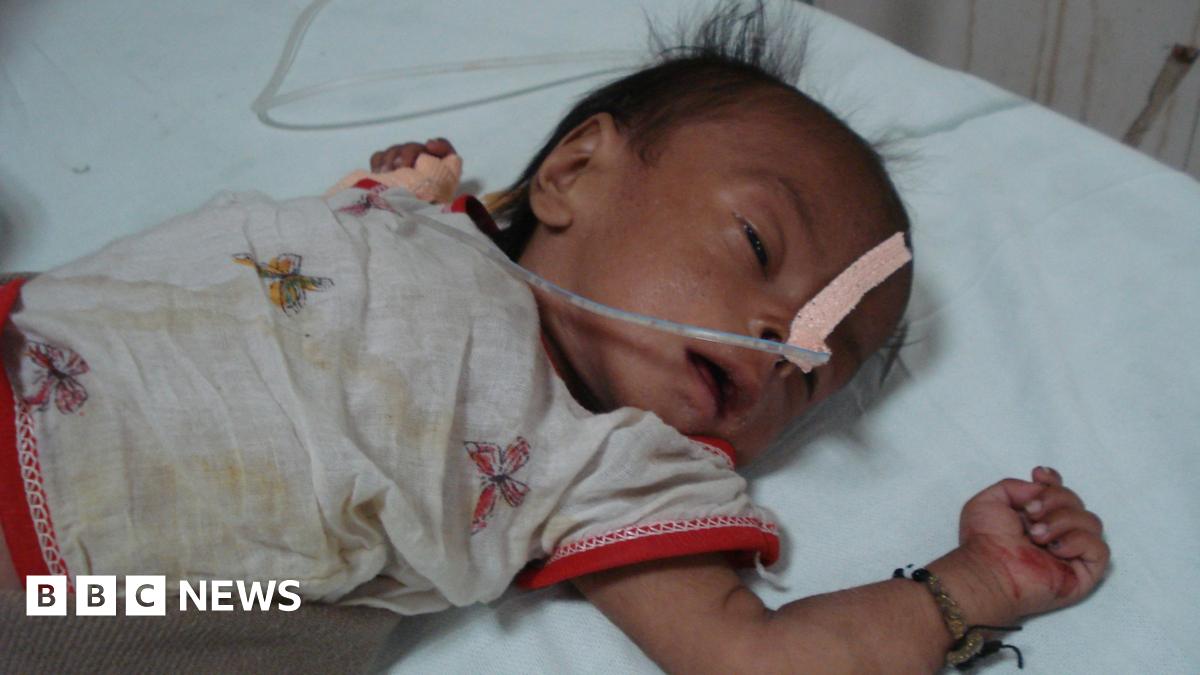 Indian baby who was 'buried alive' - BBC News