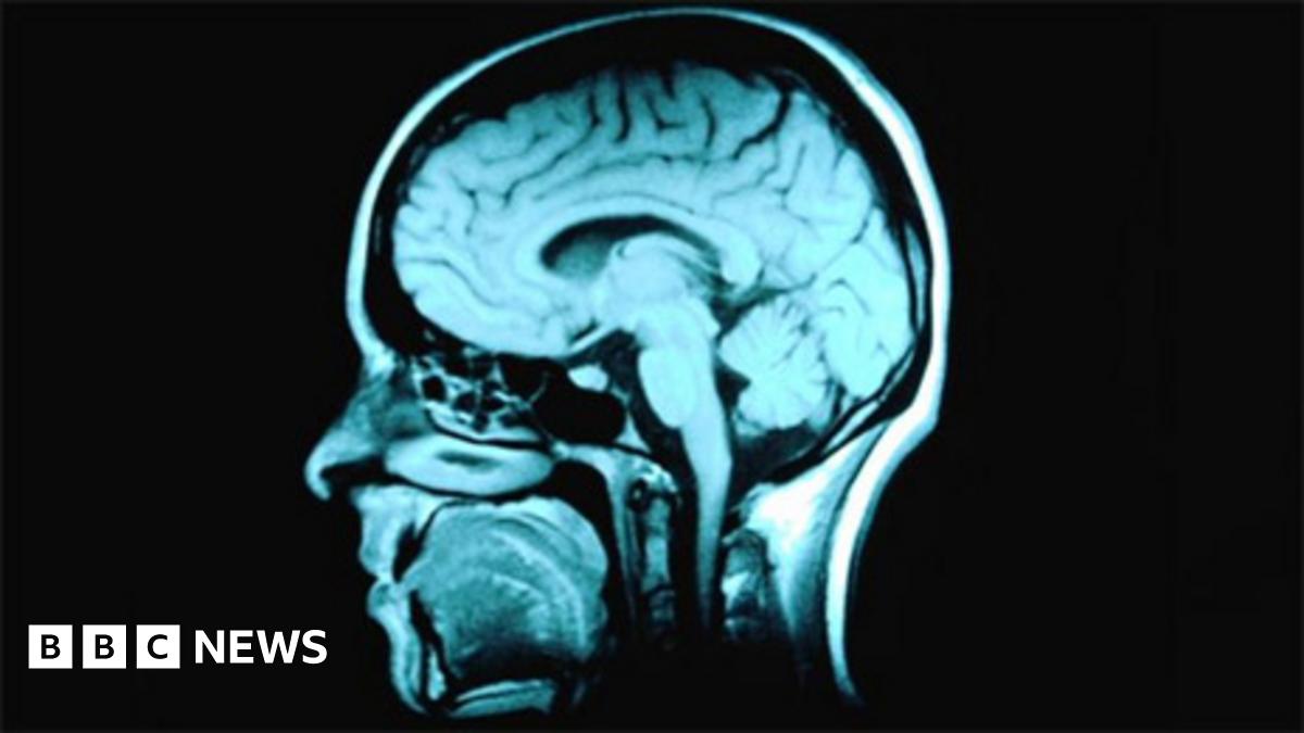 Brazil health authorities investigate MRI scan deaths - BBC News