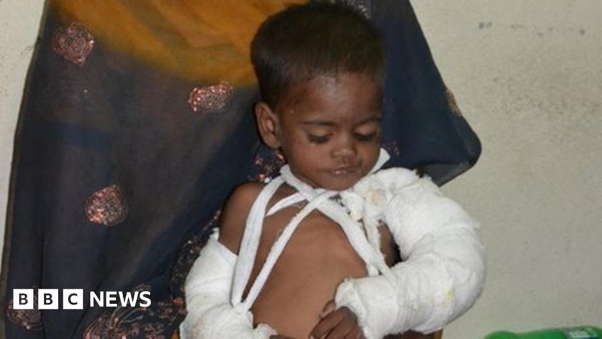 India girl Baby Shirin battered, burnt with cigarettes - BBC News