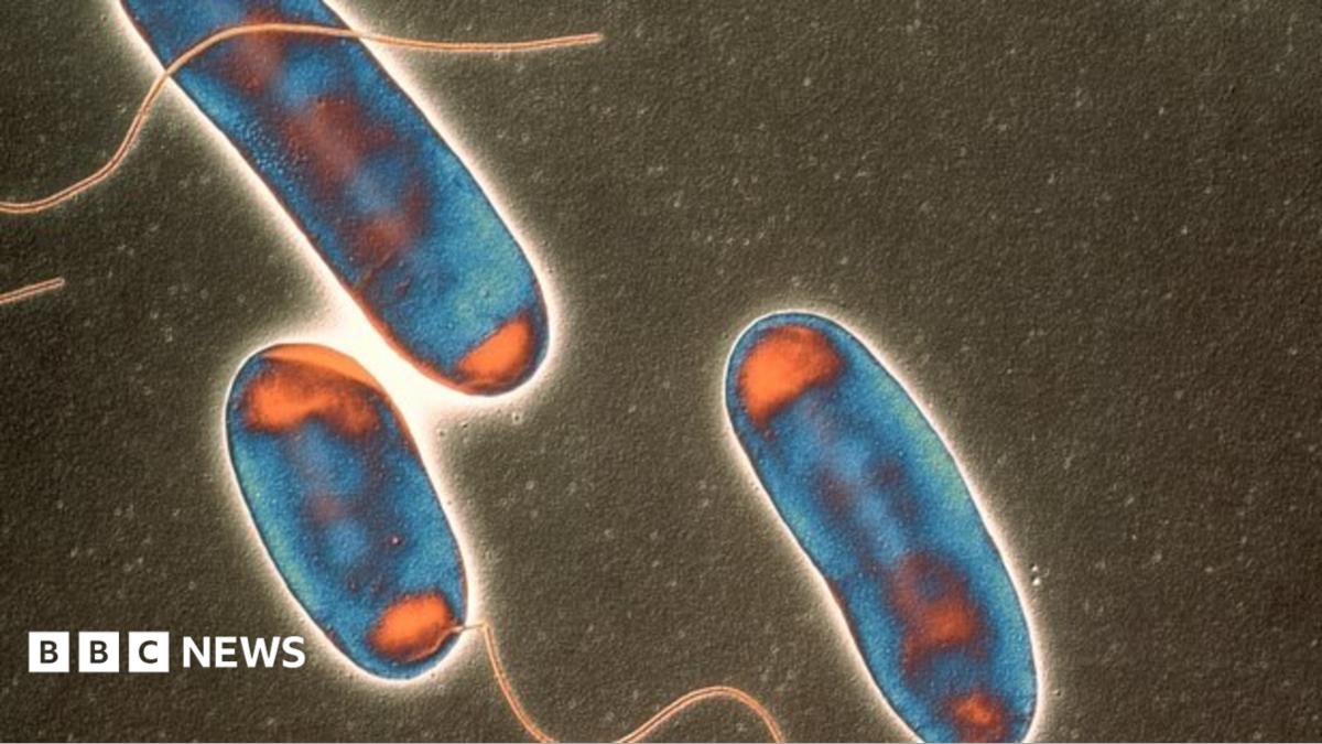 Q&A: Edinburgh Legionnaires' disease outbreak - BBC News