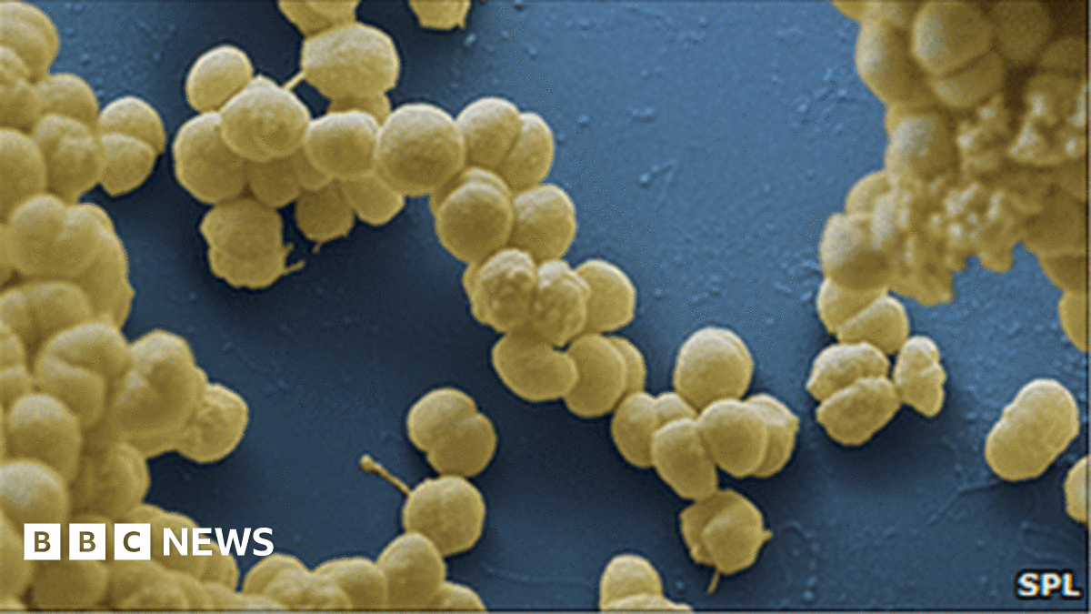 Third meningitis case in County Down - BBC News