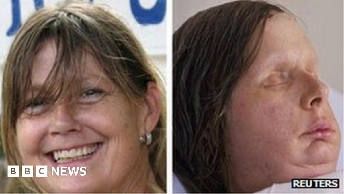 US chimp-attack victim says state failed to heed warning - BBC News