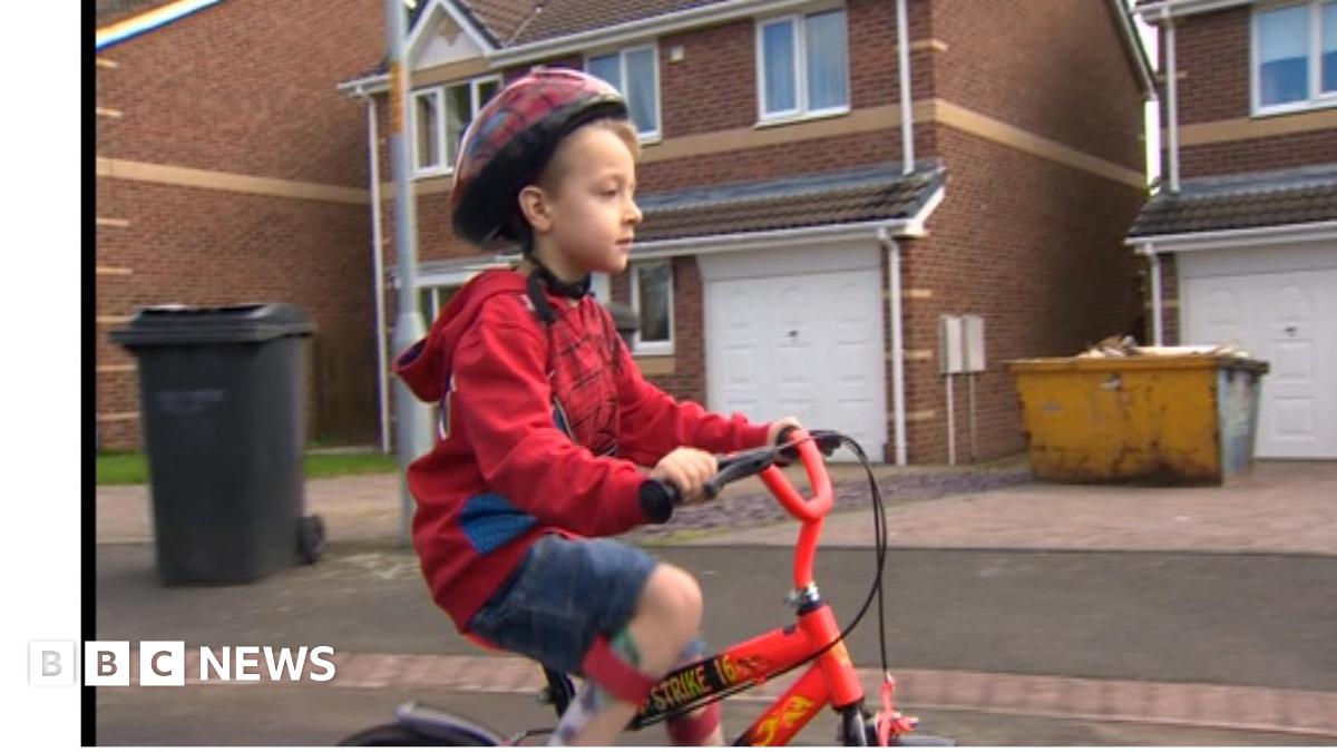 Cerebral palsy op boy Archie Anderson recovering - BBC News