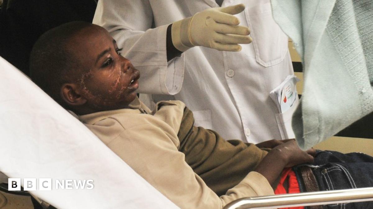 Kenyan hyena attack boy Musa Jelle treated in Nairobi - BBC News