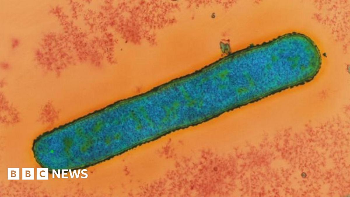 Case of anthrax confirmed in Lanarkshire heroin user - BBC News