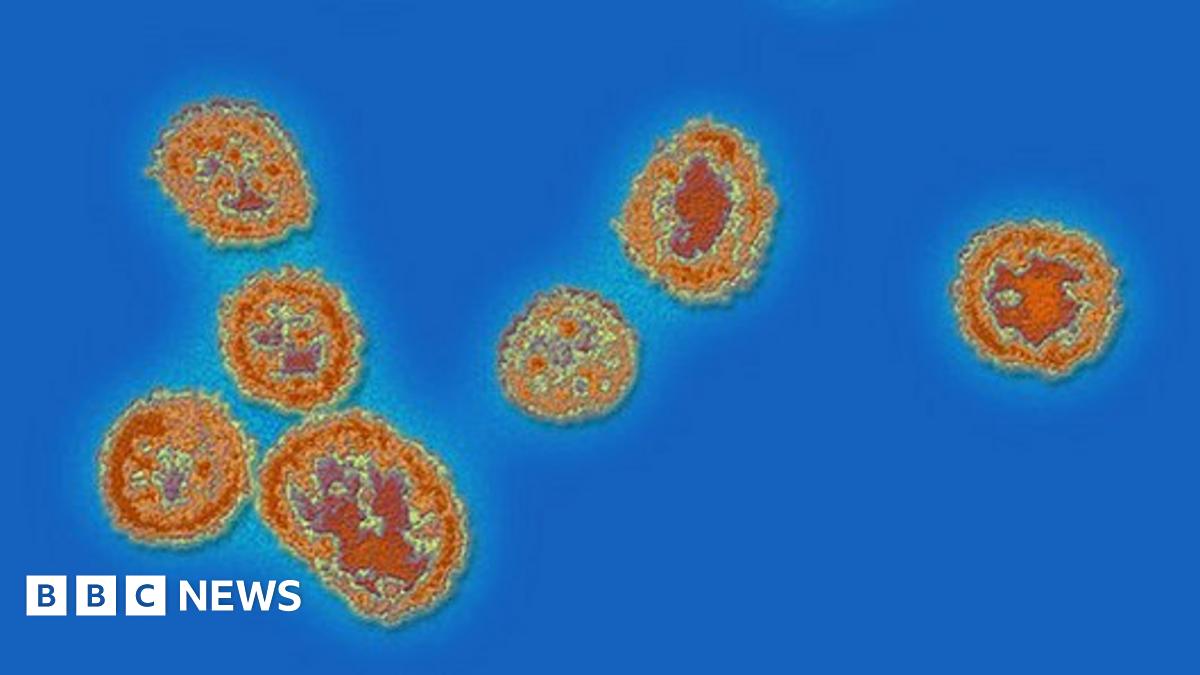 Lethal snake viruses identified - BBC News