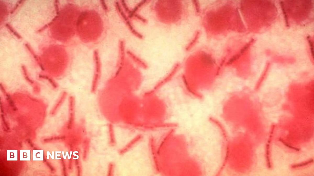 Fifth UK drug user is infected with anthrax - BBC News