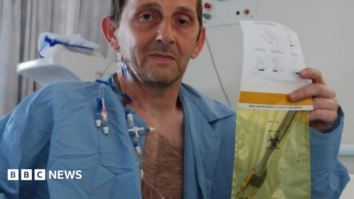 Nine-inch fork removed from man's stomach after 10 years - BBC News