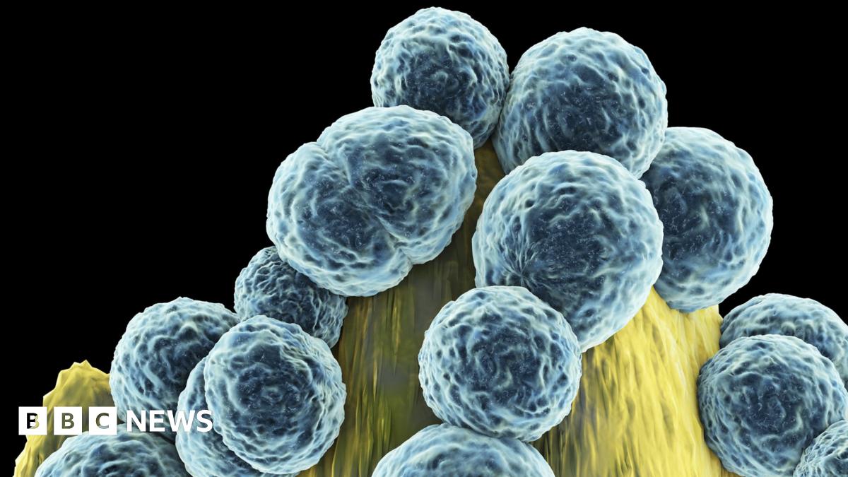 MRSA and C. diff deaths fall again - BBC News
