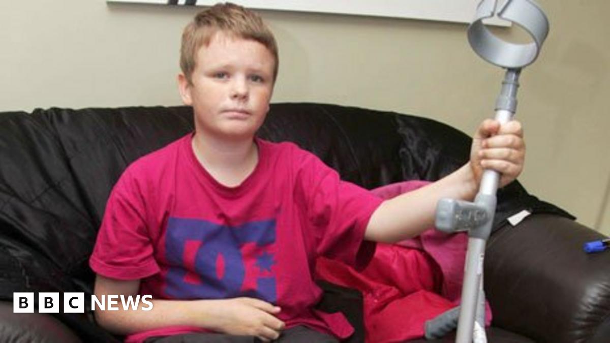 Propeller leg boy Cian Wyn Williams has 700 stitches - BBC News