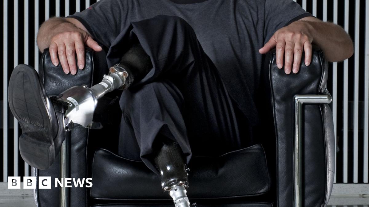 Bionic revolution: The tech getting disabled people into work - BBC News