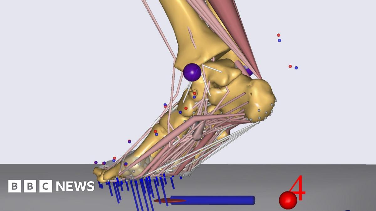Virtual foot set to help healing - BBC News