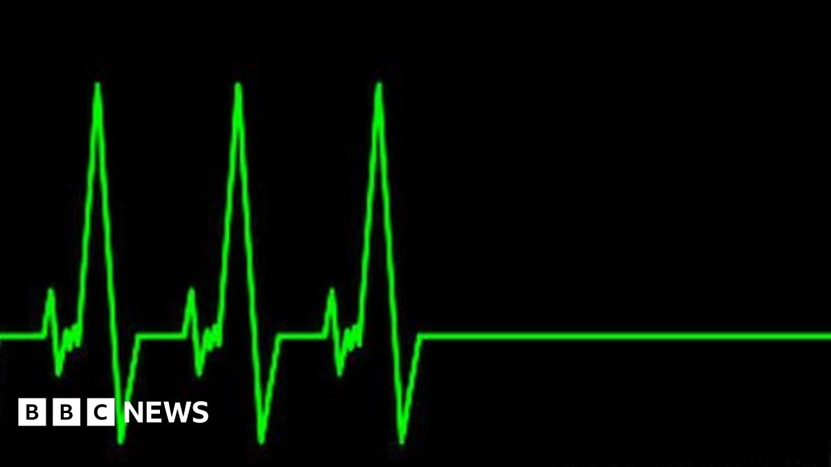 How easy is it to diagnose death? - BBC News