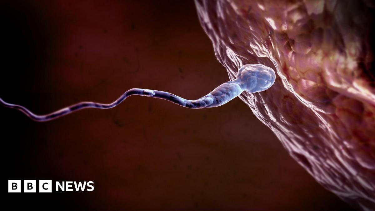 Stem cell op may 'restore sperm' - BBC News
