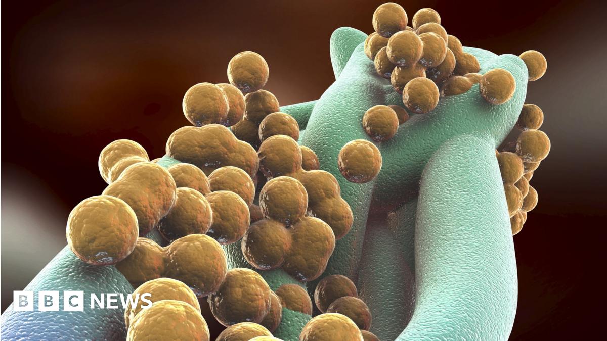 DNA sequencing of MRSA used to stop outbreak - BBC News