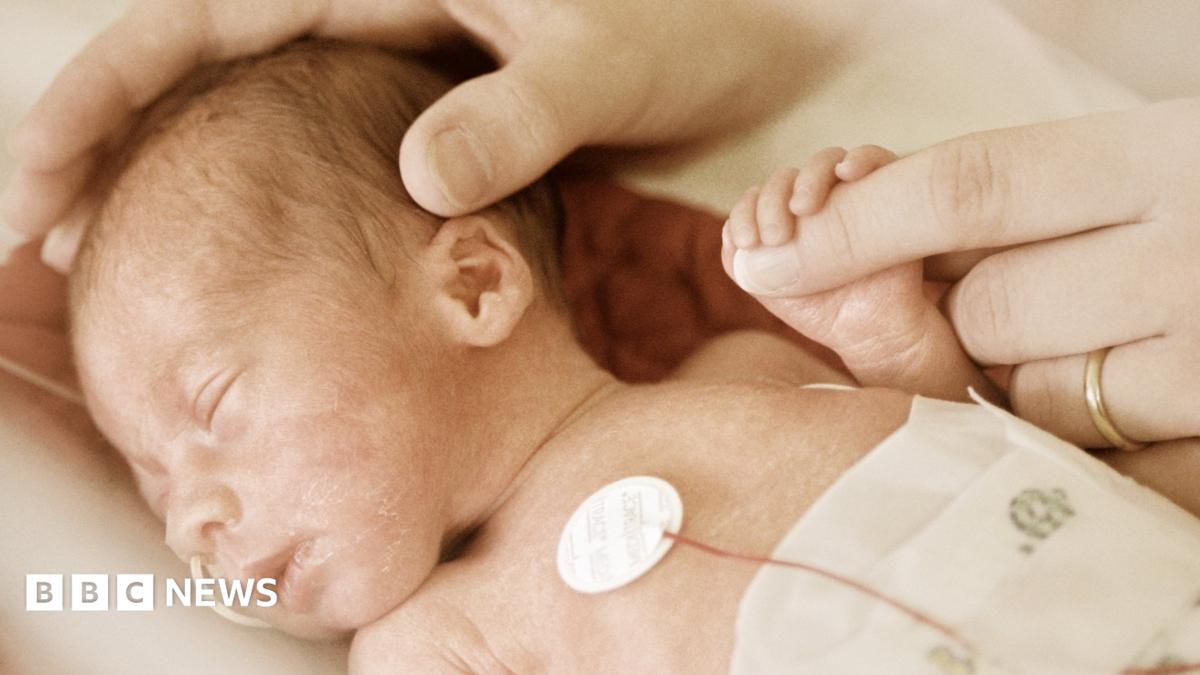 Severely premature babies: More survive being born early - BBC News