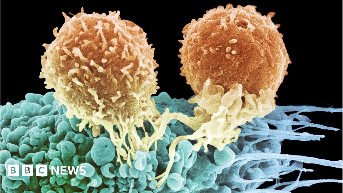 Immune system 'booster' may hit cancer - BBC News