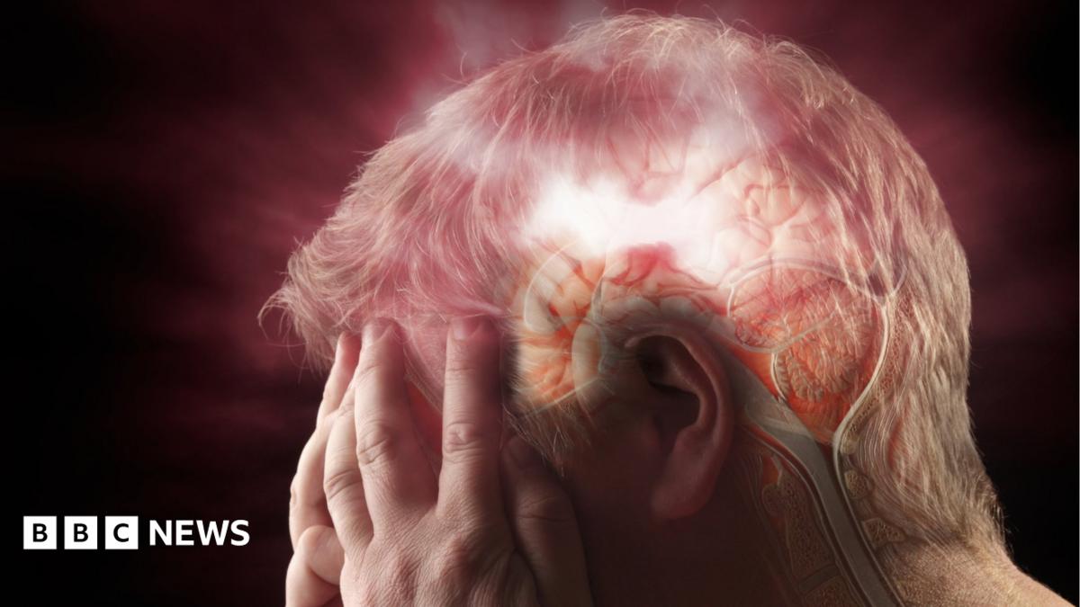 Brain's 'stroke shielding' cracked - BBC News