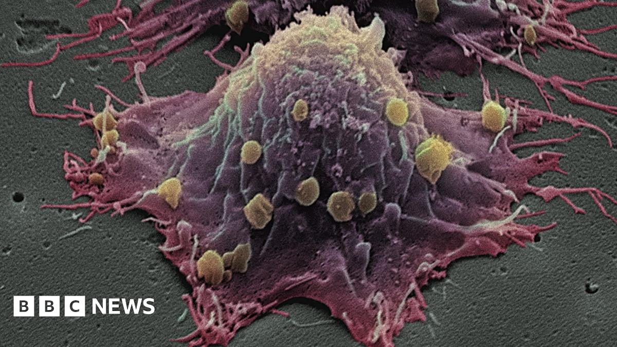 Thriving cancer's 'chaos' explained - BBC News