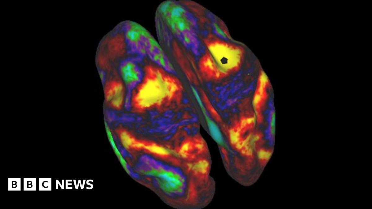 World's most detailed scans will reveal how brain works - BBC News