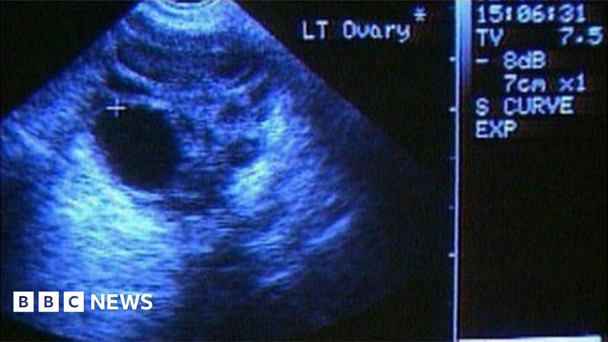 Dundee-led project to create an ultrasound pill awarded £5m - BBC News