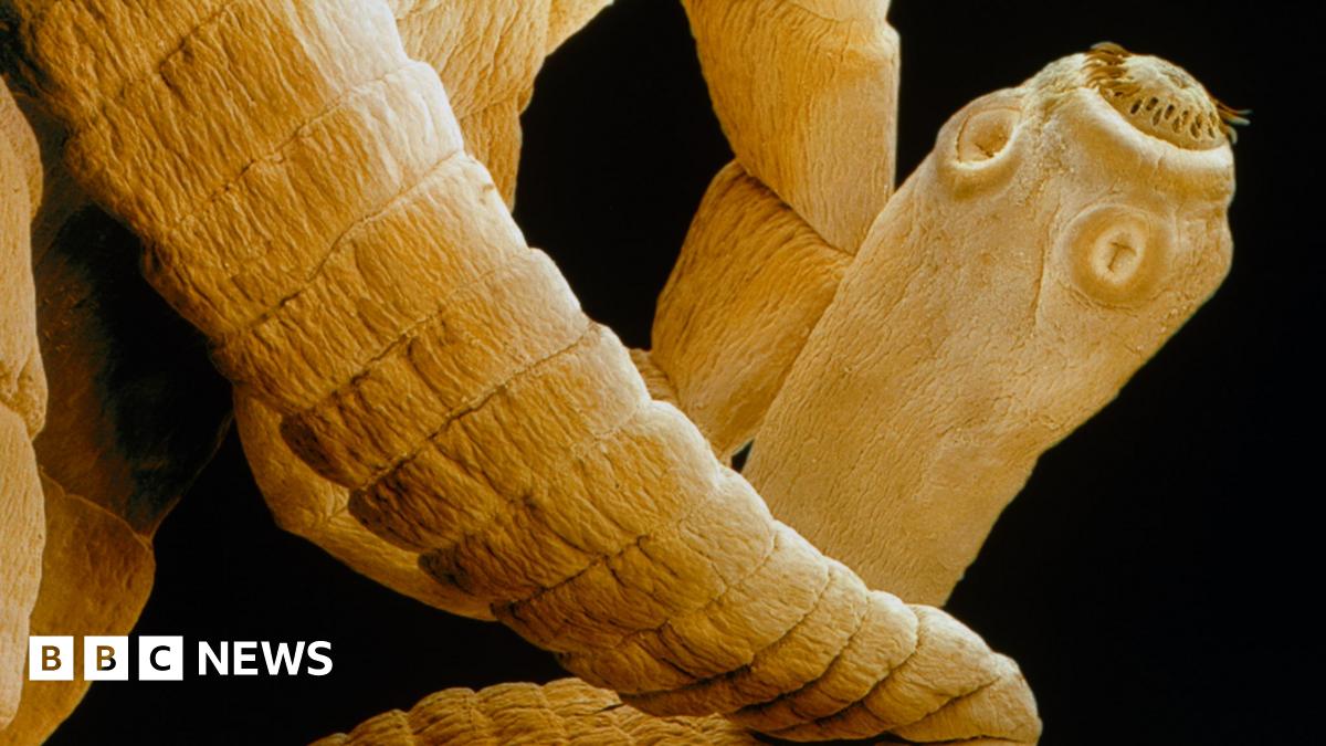 'Weakness mining' for tapeworm drugs - BBC News